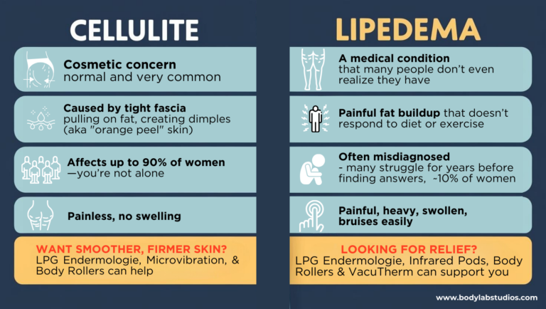 Cellulite vs. Lipedema - How to Tell the Difference Over Coffee